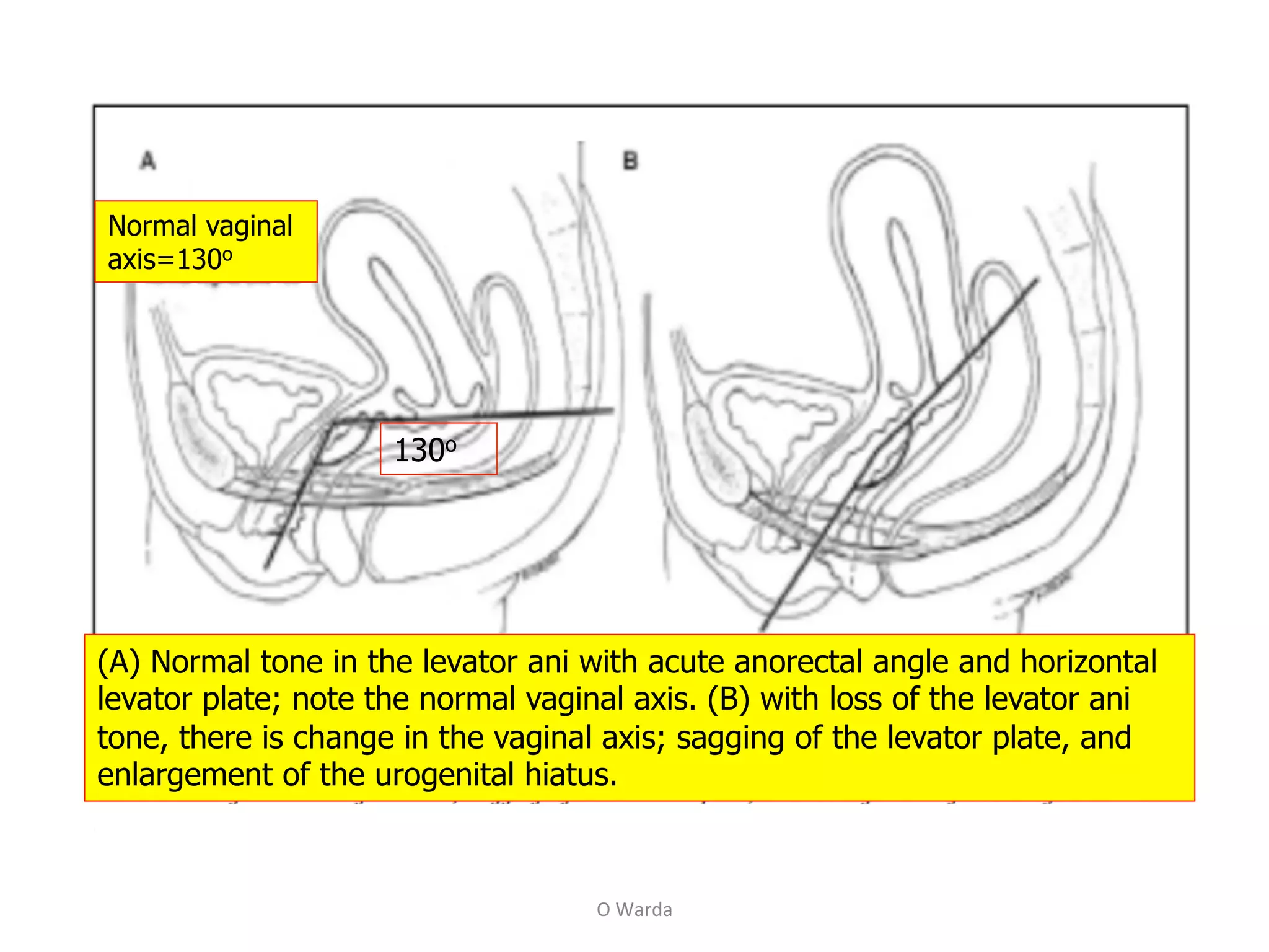 2 female pelvic anatomy warda (part 2) | PDF