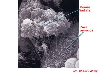 Fertilization (General Embryology) | PPS