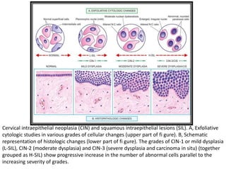 FEMALE GENITAL SYSTEM: CERVIX LESIONS | PPTX