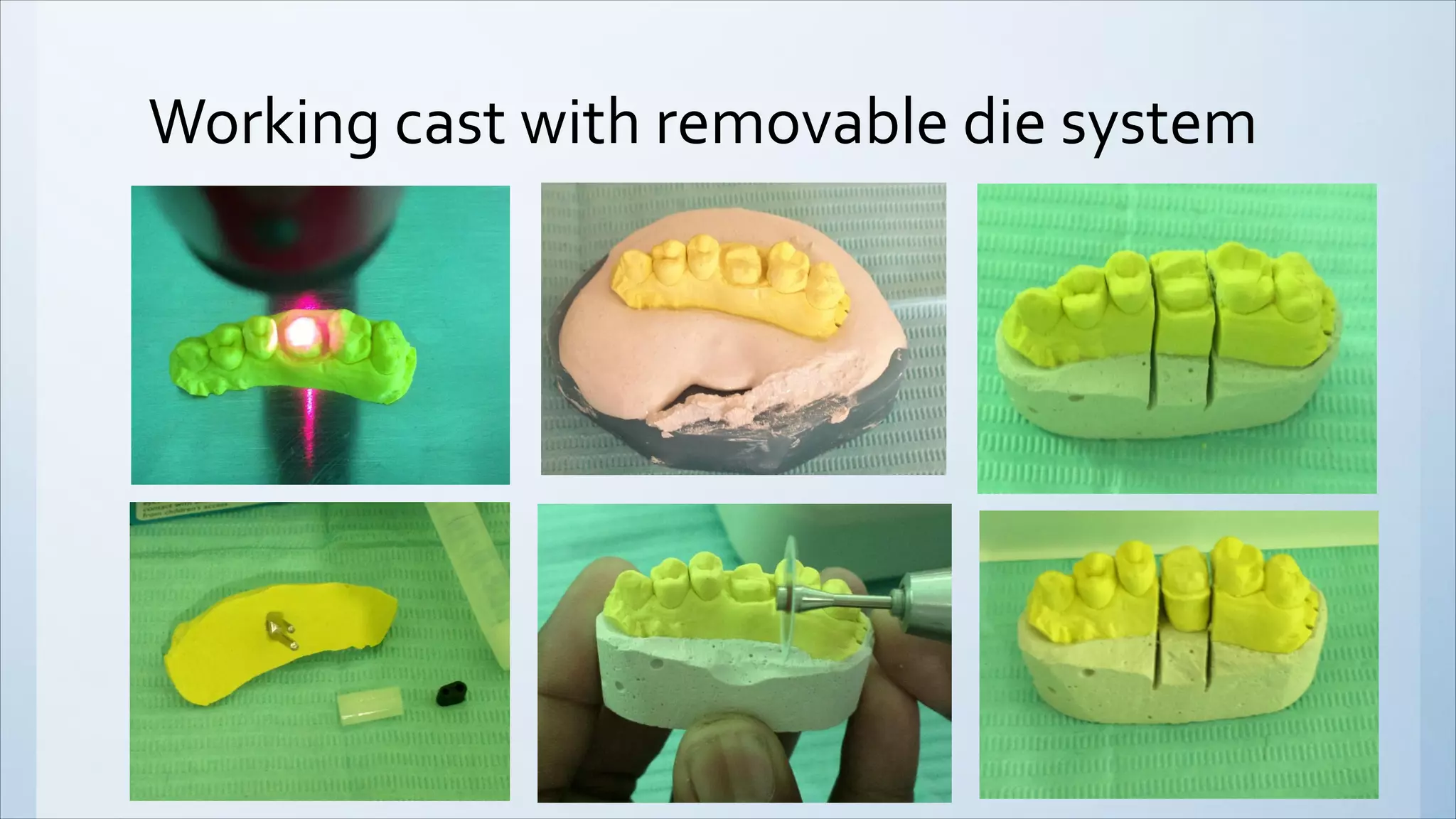 2-Fixed Partial Dentures-Construction @ Faryal.pdf