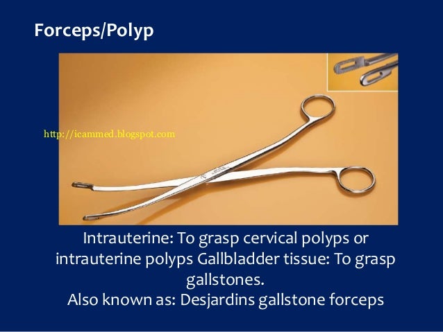 Procedure To Remove Cervical Polyps Cervical Polyp | Radiology