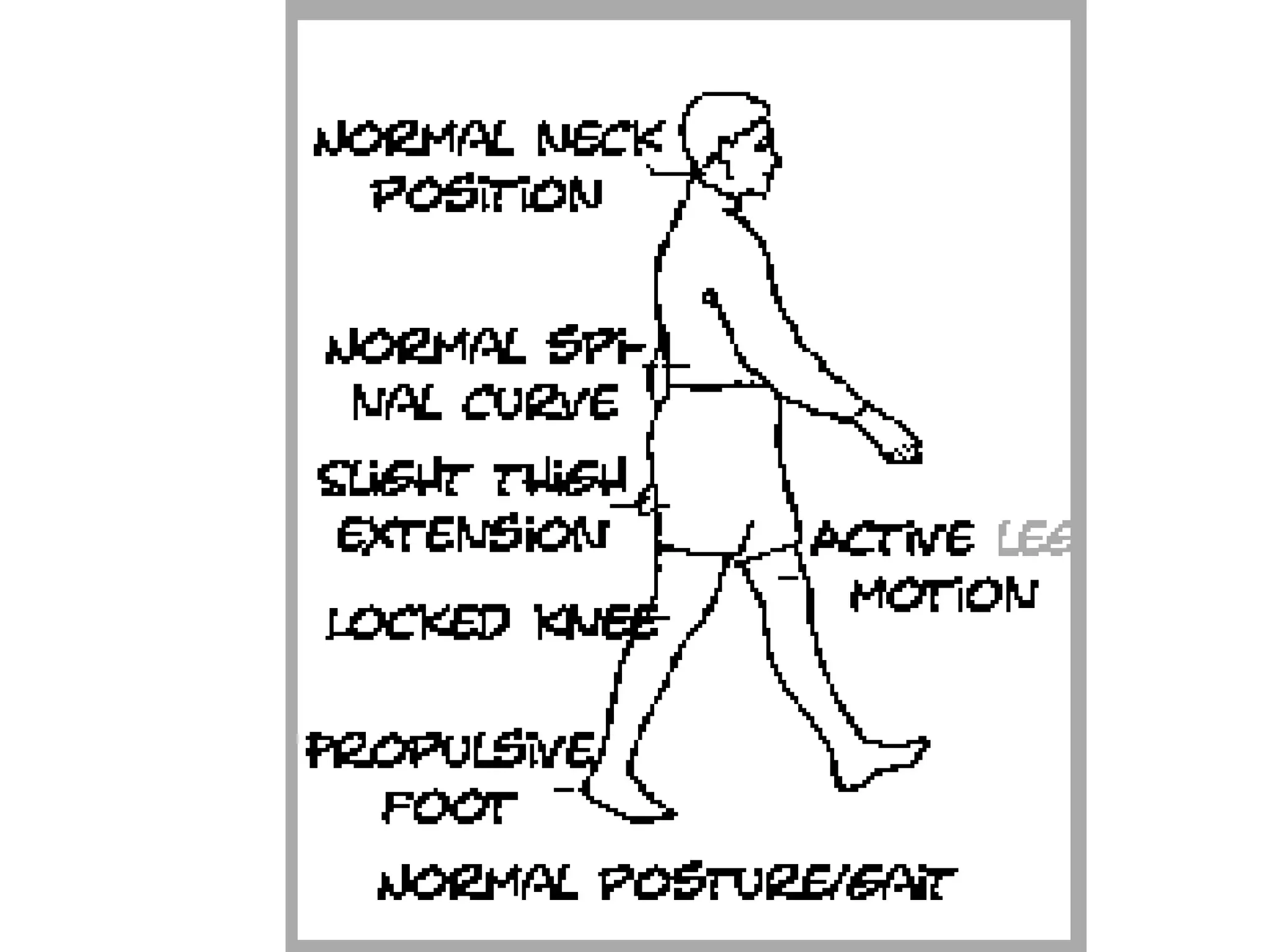 Gait analysis | PPT