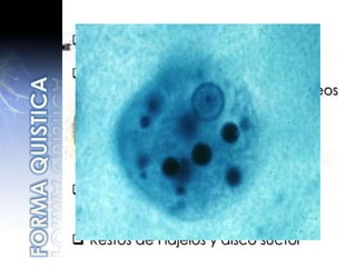 giardiasis | PPTX