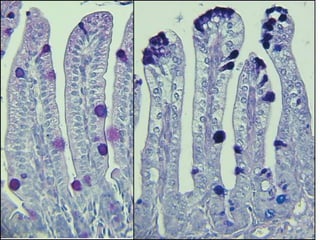giardiasis | PPTX