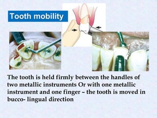 2- Gingivitis and periodontitis.pdf