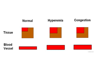 2 hyperemia-congestion | PPT