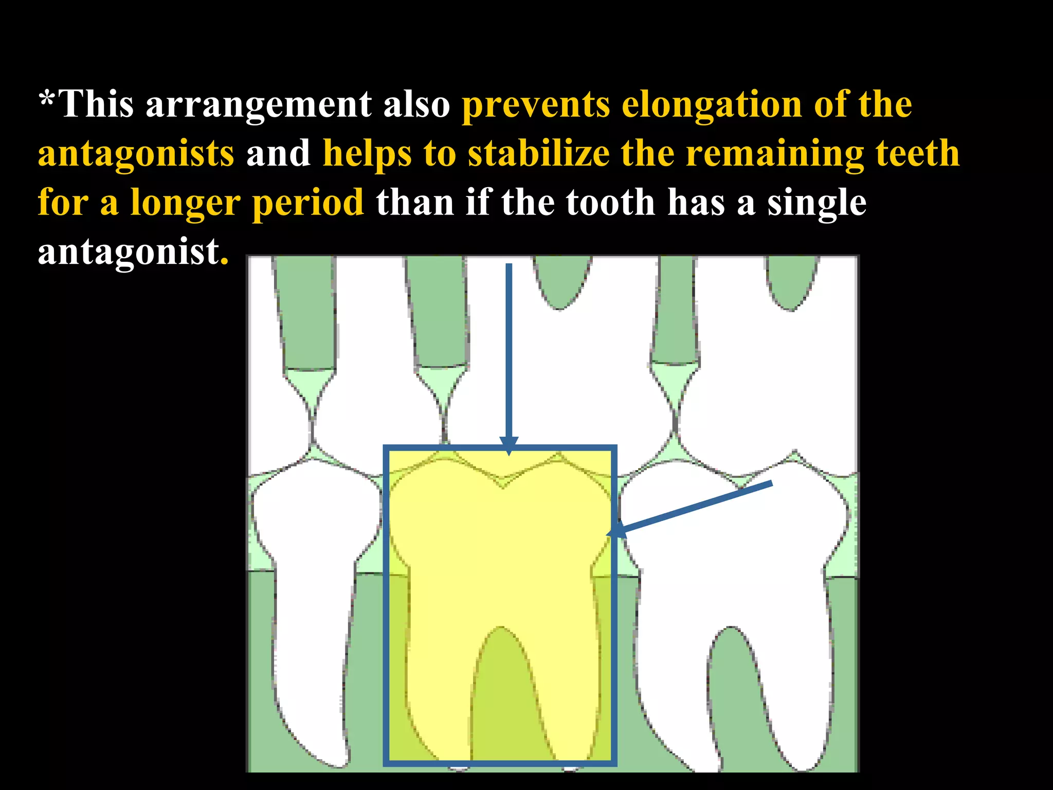 Dentition Ch. 2 - Incisors | PPT