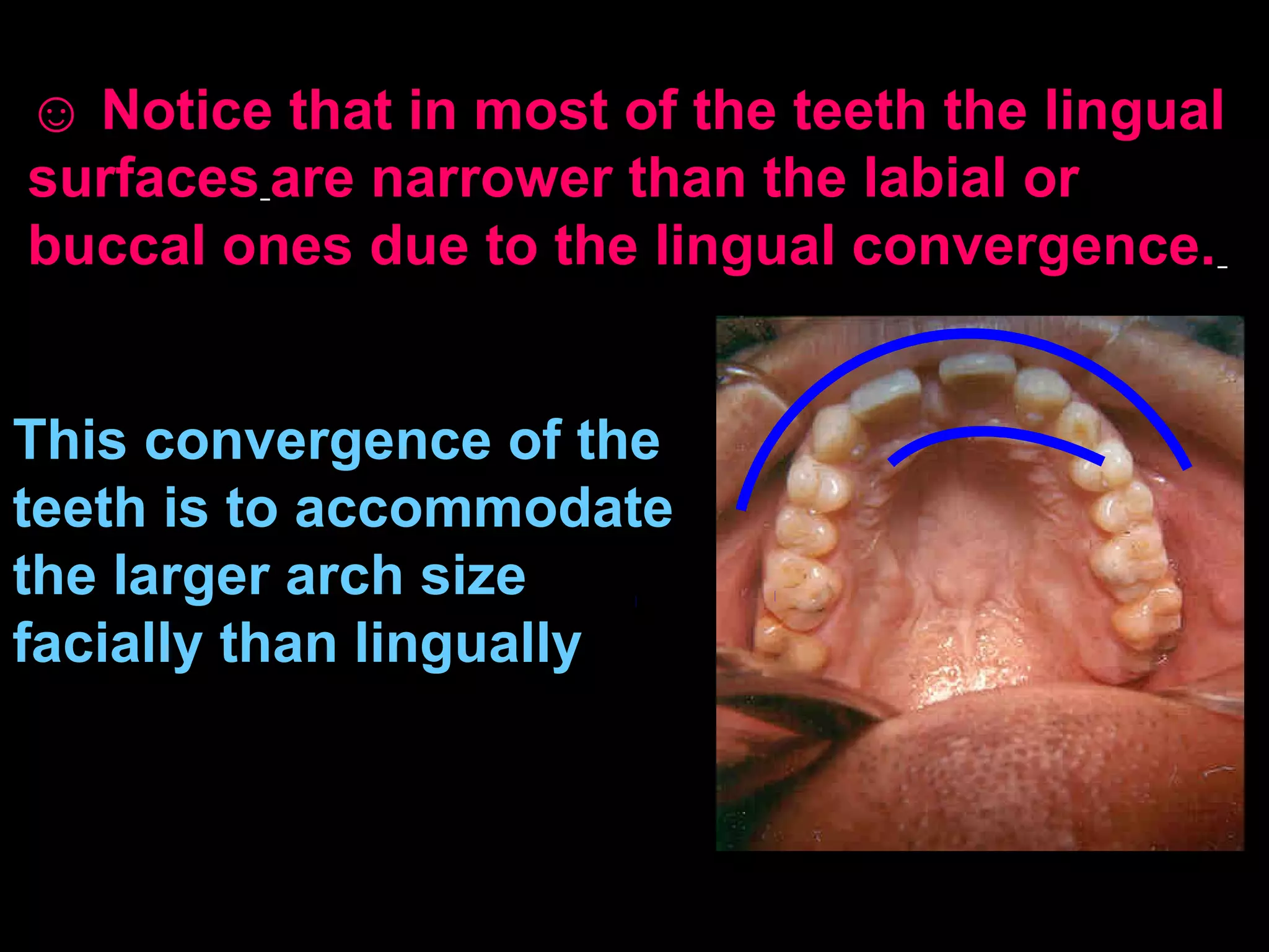 Dentition Ch. 2 - Incisors | PPT