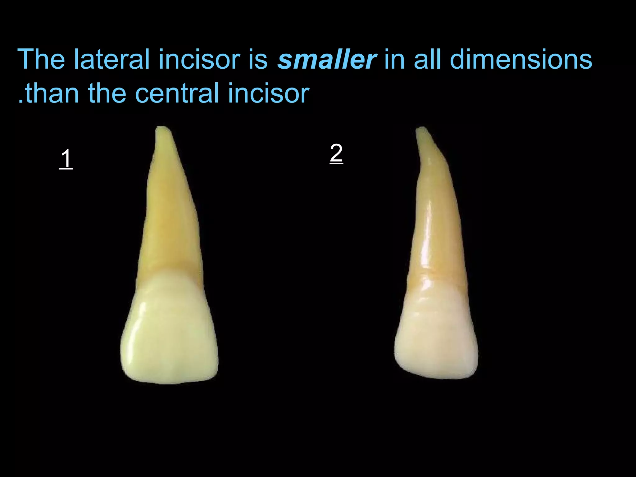 Dentition Ch. 2 - Incisors | PPT