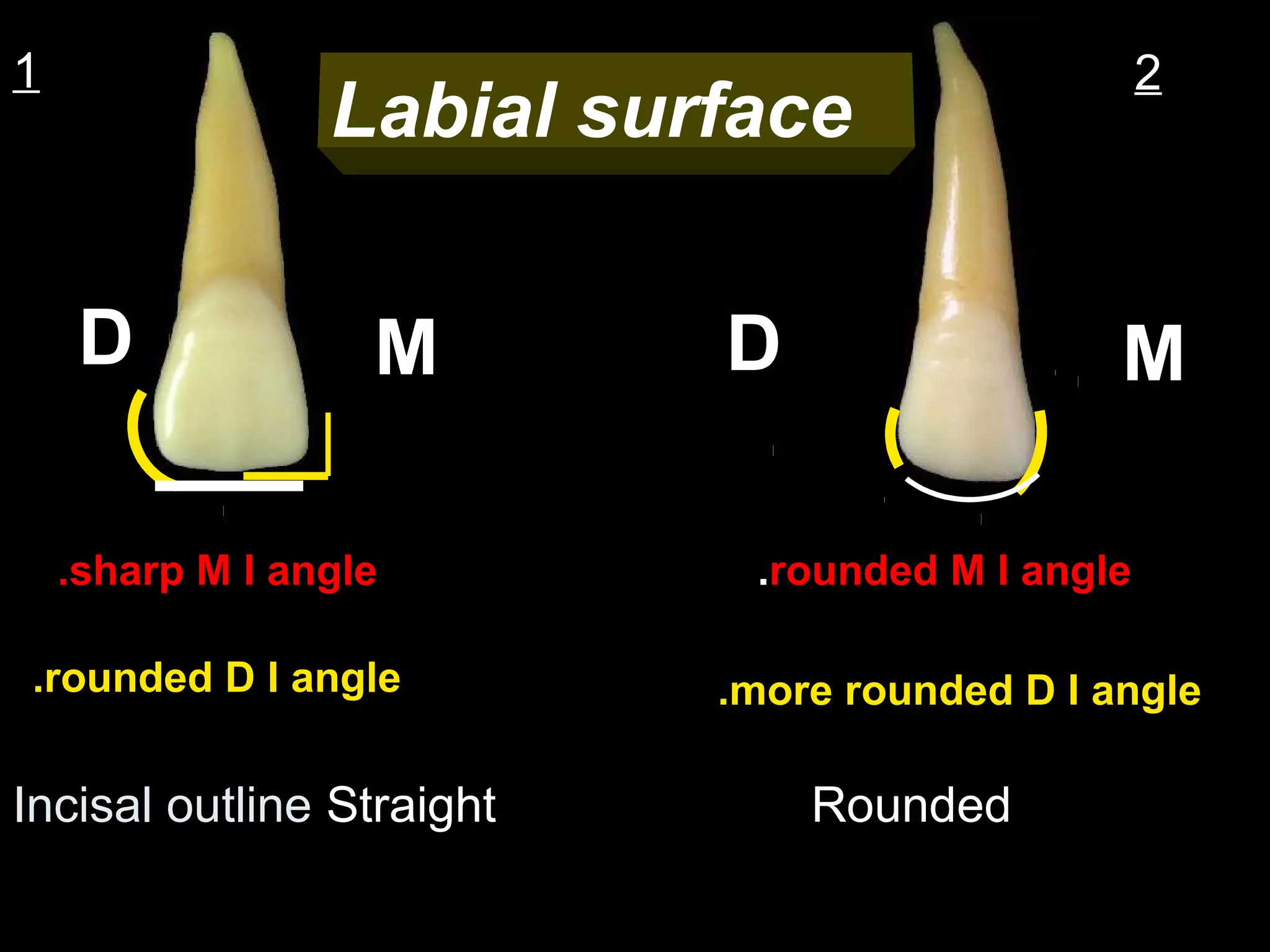 Dentition Ch. 2 - Incisors | PPT