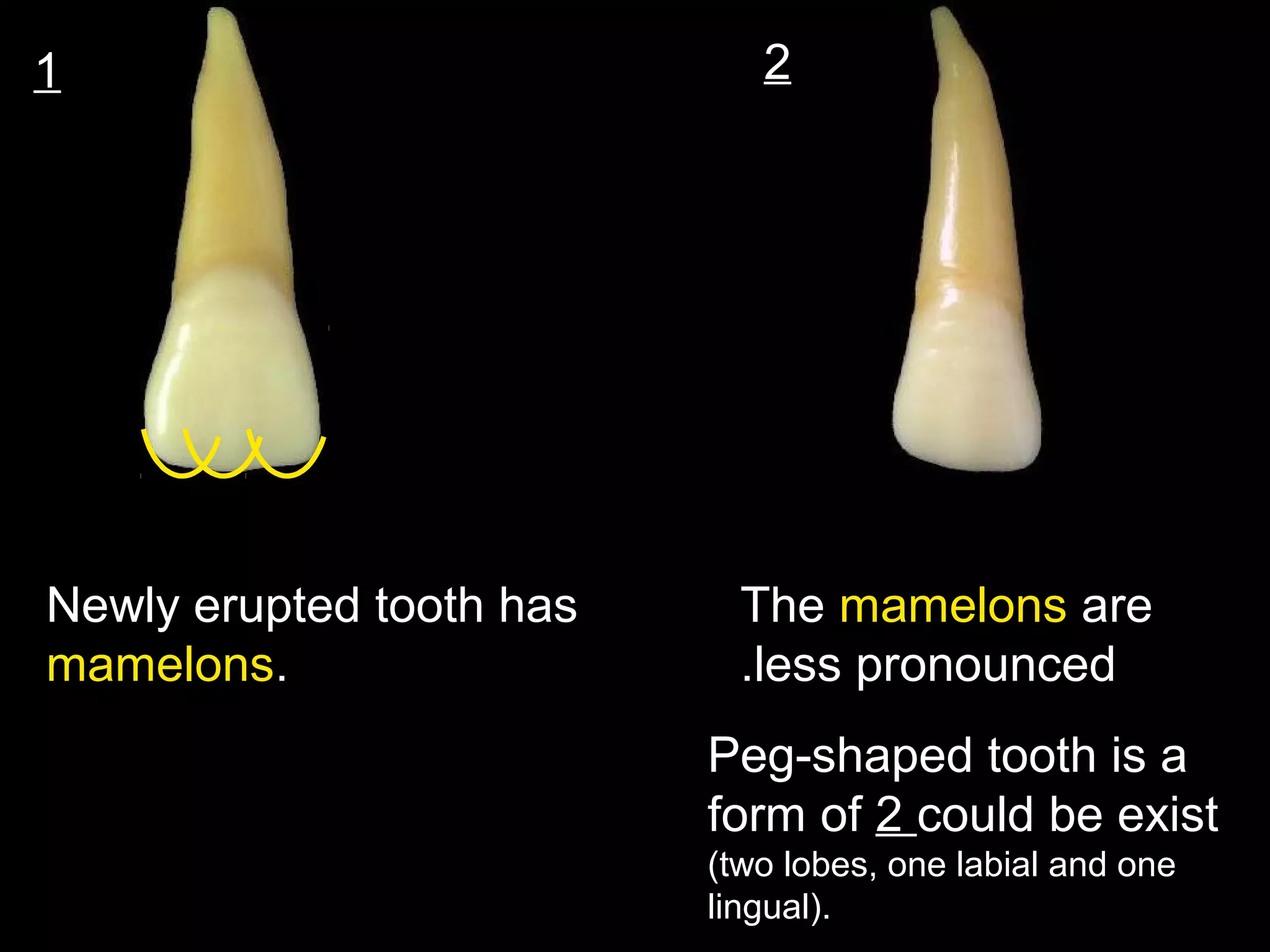 Dentition Ch. 2 - Incisors | PPT