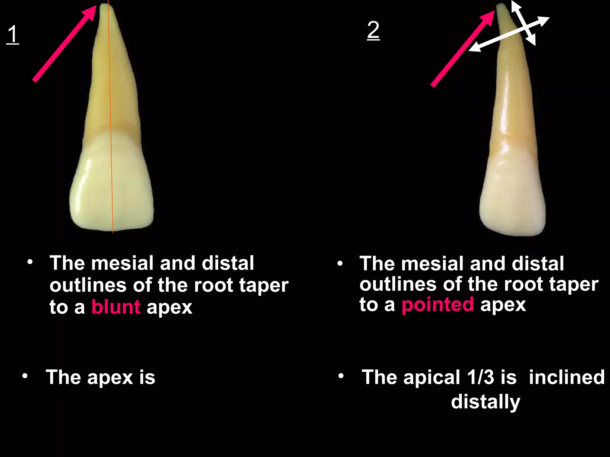 Dentition Ch. 2 - Incisors | PPT