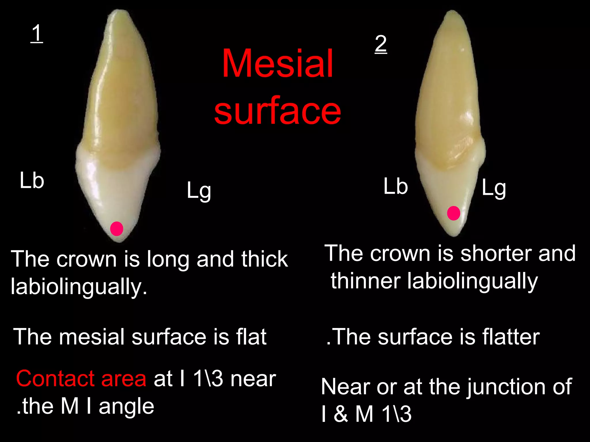 Dentition Ch. 2 - Incisors | PPT