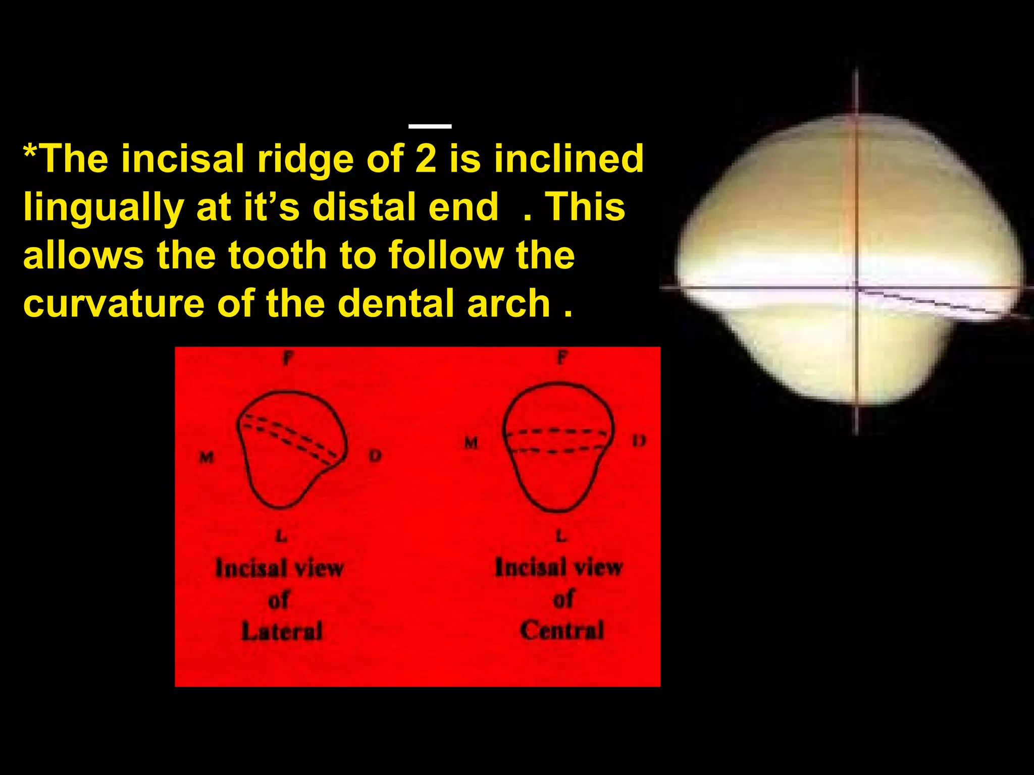 Dentition Ch. 2 - Incisors | PPT