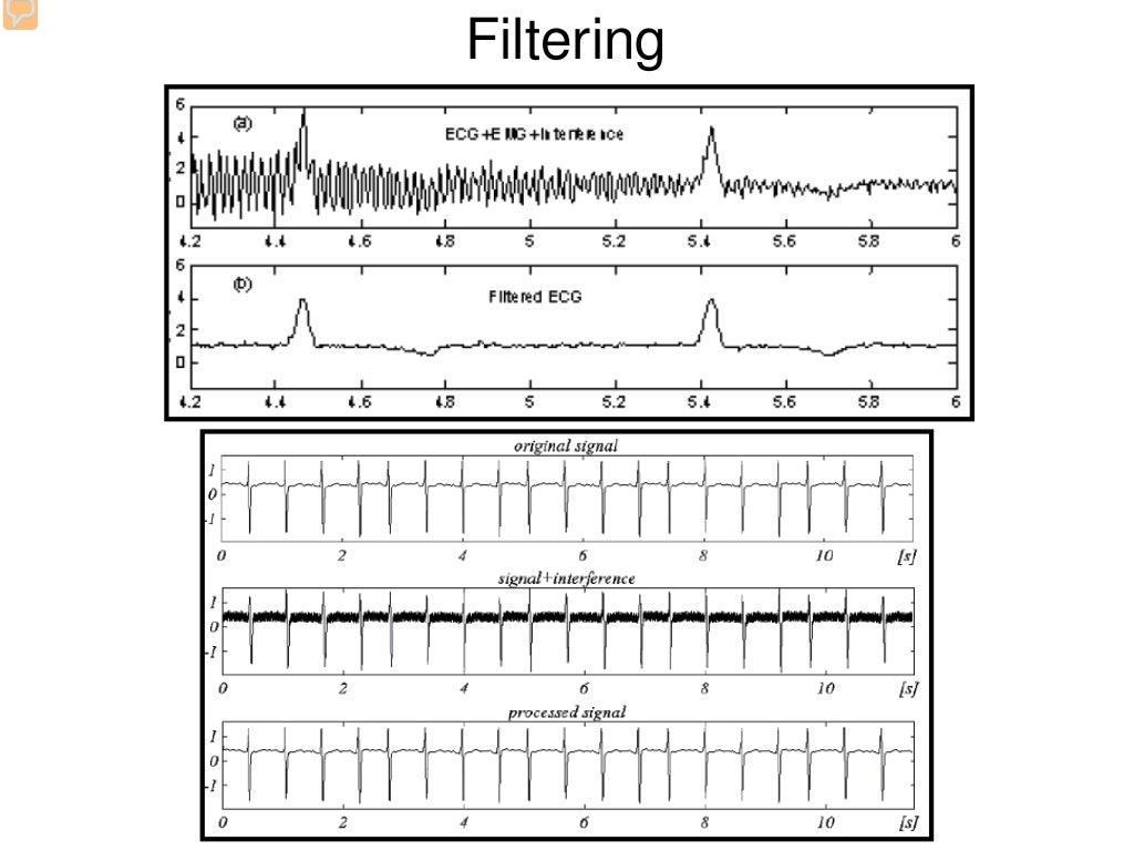 Intracardiac Electrograms