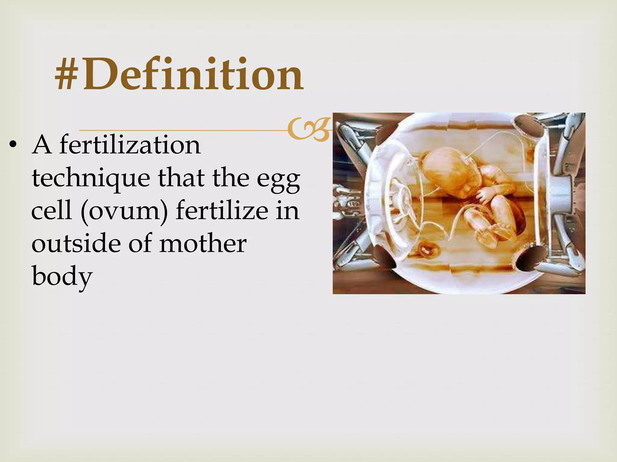 2 in vitro fertilization | PPT