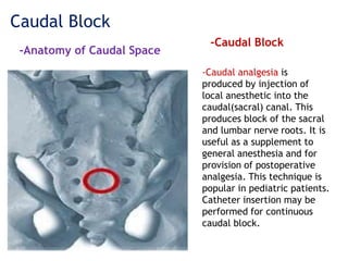 local and regional anesthesia | PPT