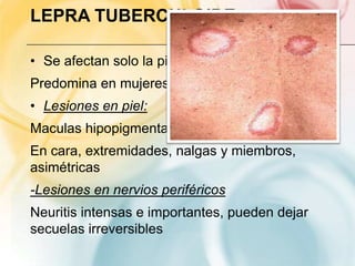 2 lepra exposicion | PPTX