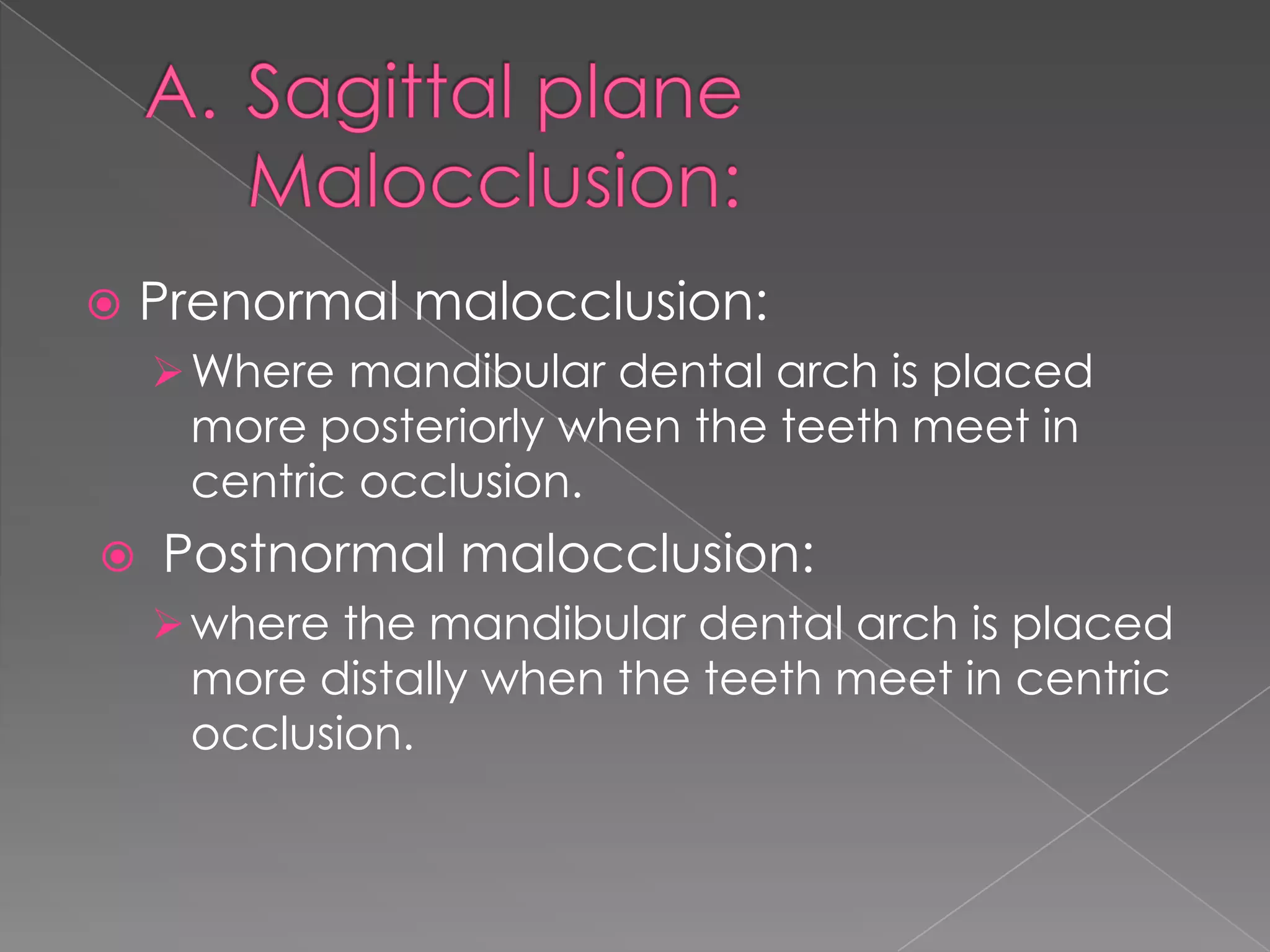 2. malocclusion | PPTX
