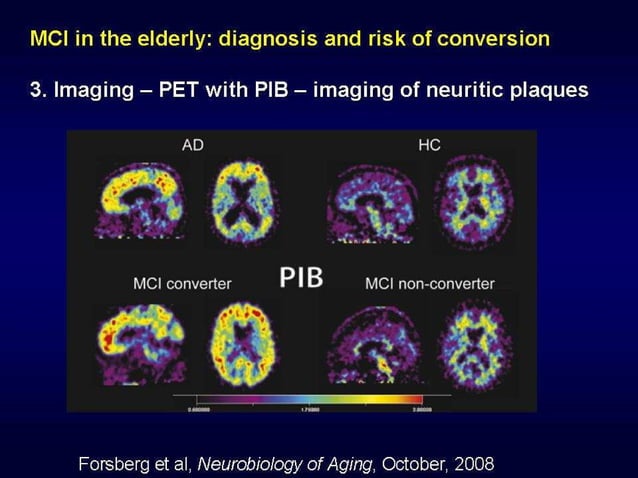 MCI in the elderly | PDF