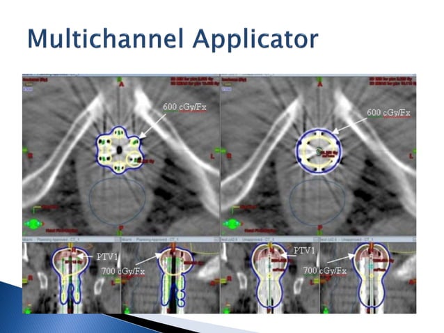 2-multichannel yb | PPT