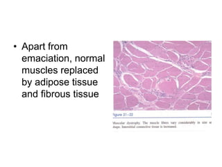 Veterinary Pathology of Muscular System | PPT