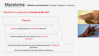 2-mycetoma.pptx for studing bsc mlt mycology | PPT