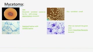 2-mycetoma.pptx for studing bsc mlt mycology | PPT