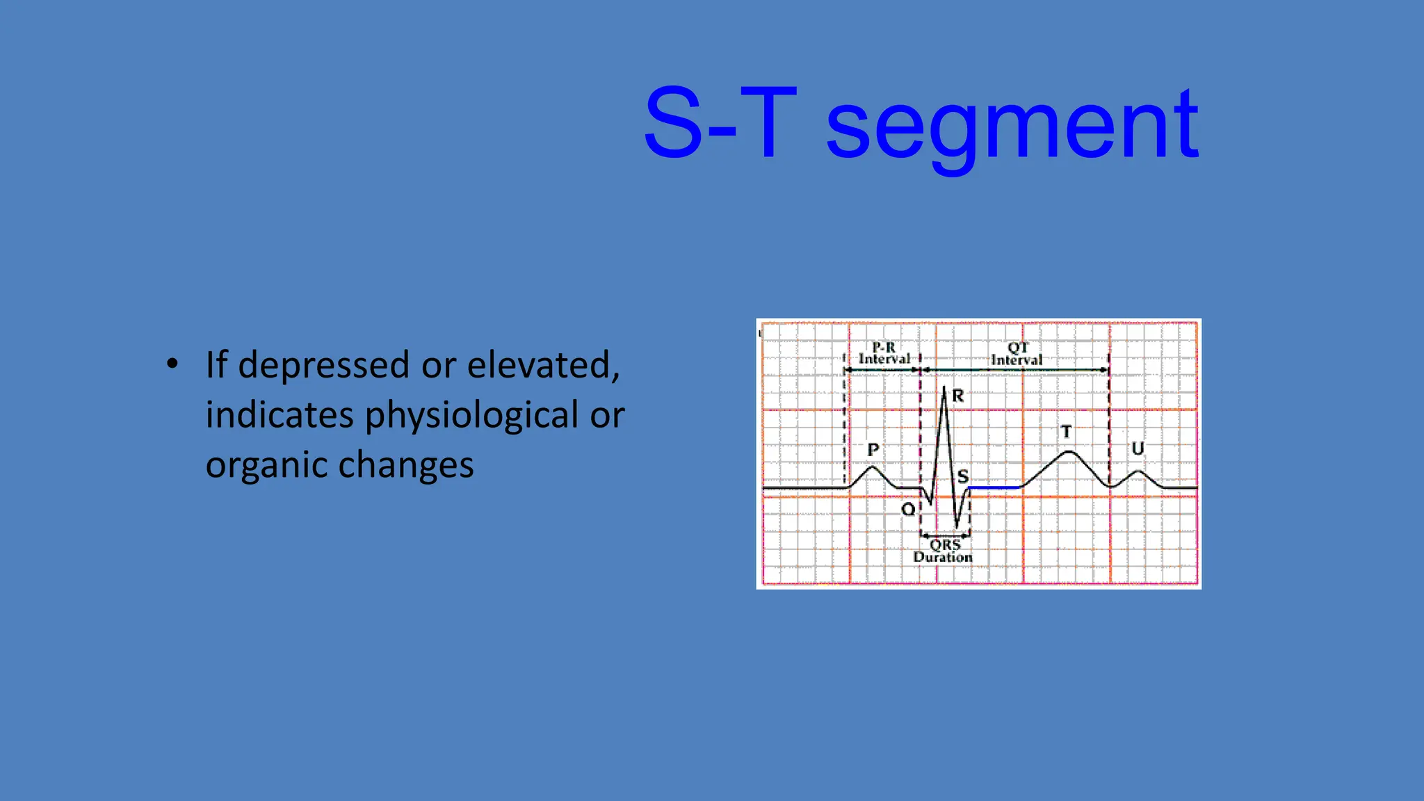 2- nursing care for Myocardial Infarction.pptx