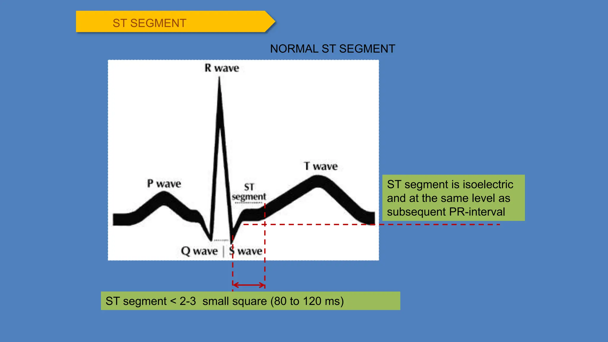 2- nursing care for Myocardial Infarction.pptx