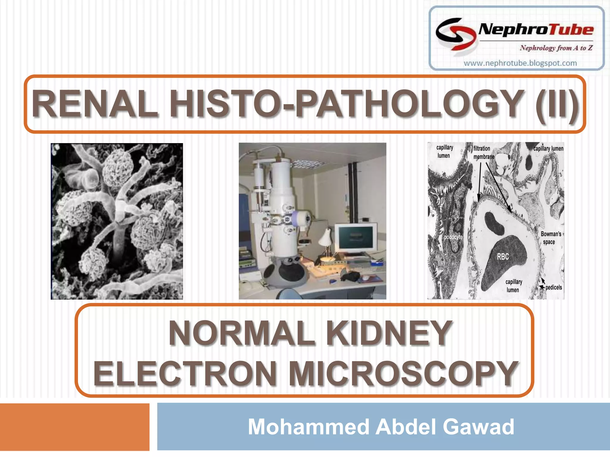 Renal Histo-Pathology (II) - Normal Kidney Electron Microscopy - Dr ...