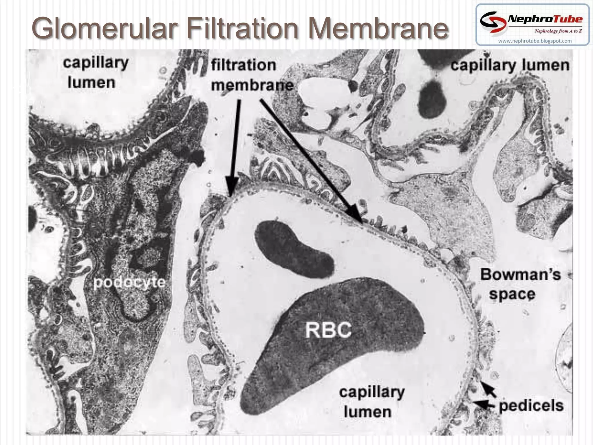 Renal Histo-Pathology (II) - Normal Kidney Electron Microscopy - Dr ...