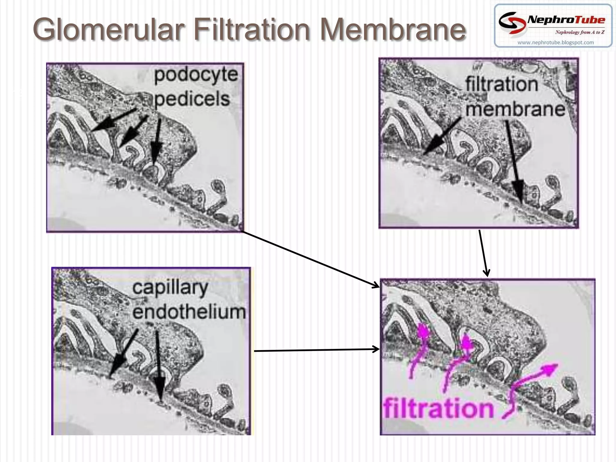 Renal Histo-Pathology (II) - Normal Kidney Electron Microscopy - Dr ...