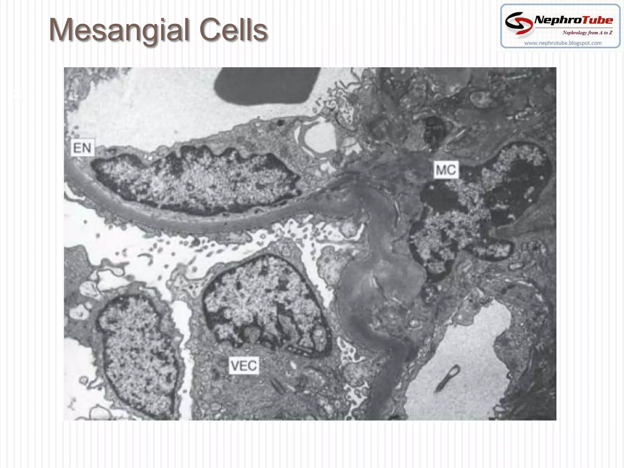 Renal Histo-Pathology (II) - Normal Kidney Electron Microscopy - Dr ...