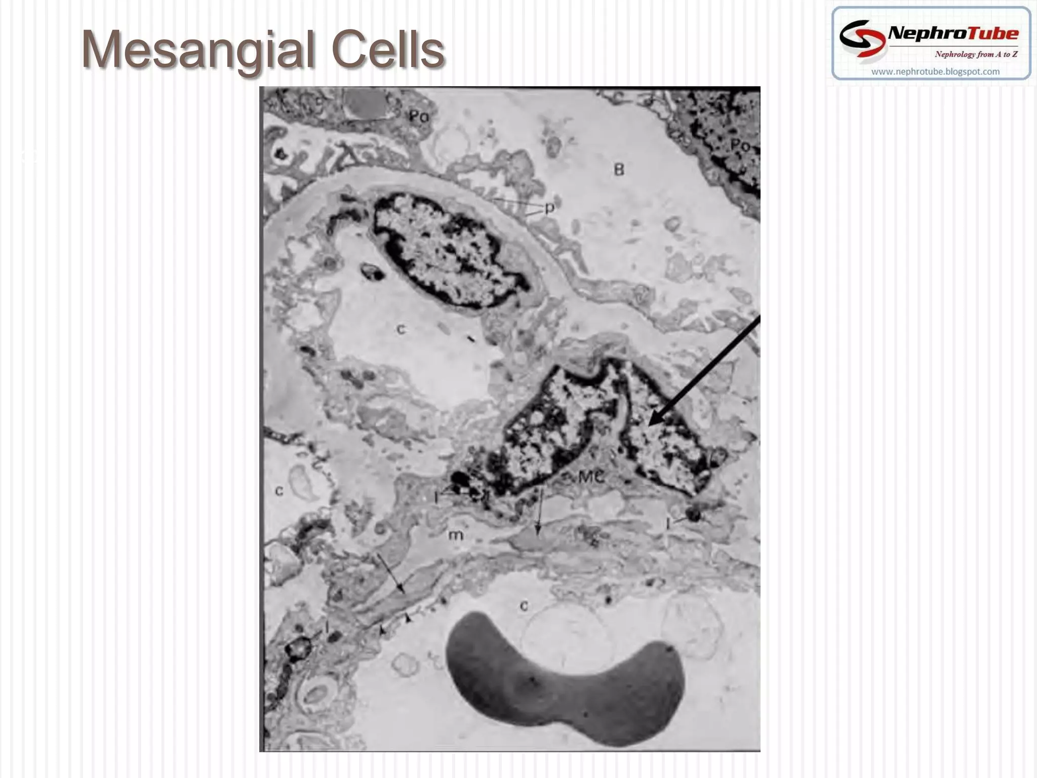 Renal Histo-Pathology (II) - Normal Kidney Electron Microscopy - Dr ...