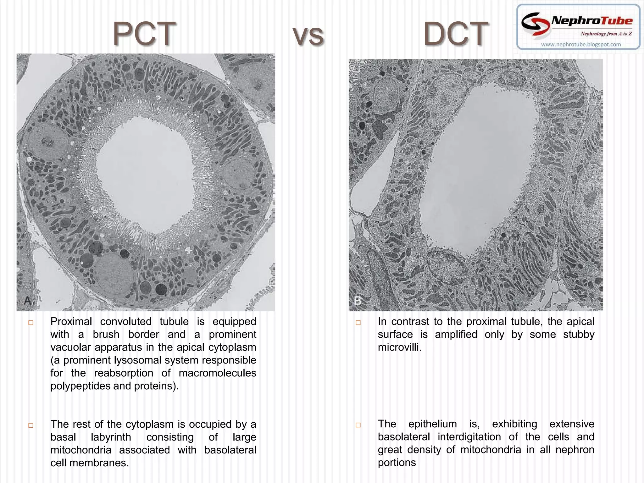 Renal Histo-Pathology (II) - Normal Kidney Electron Microscopy - Dr ...