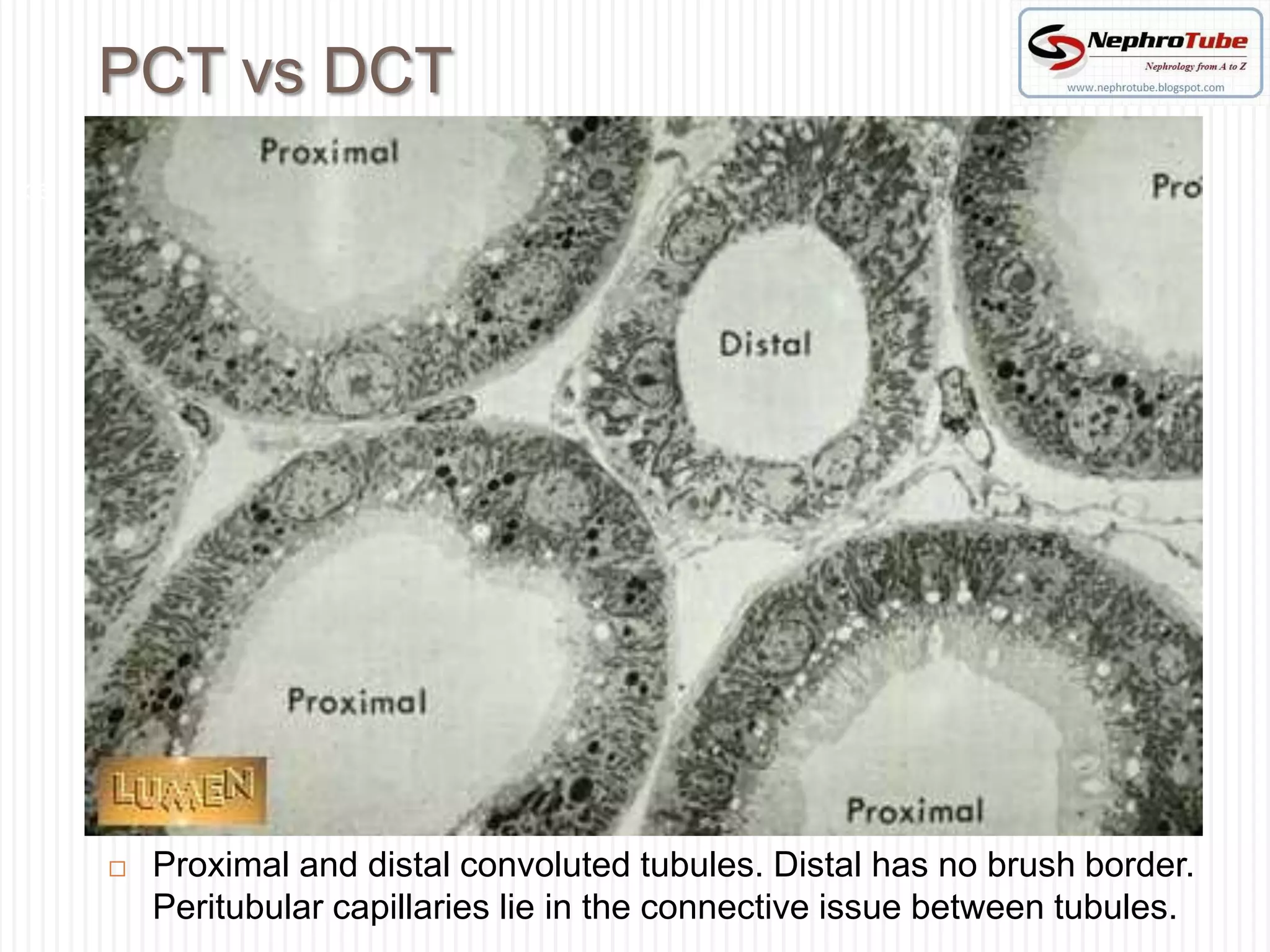 Renal Histo-Pathology (II) - Normal Kidney Electron Microscopy - Dr ...