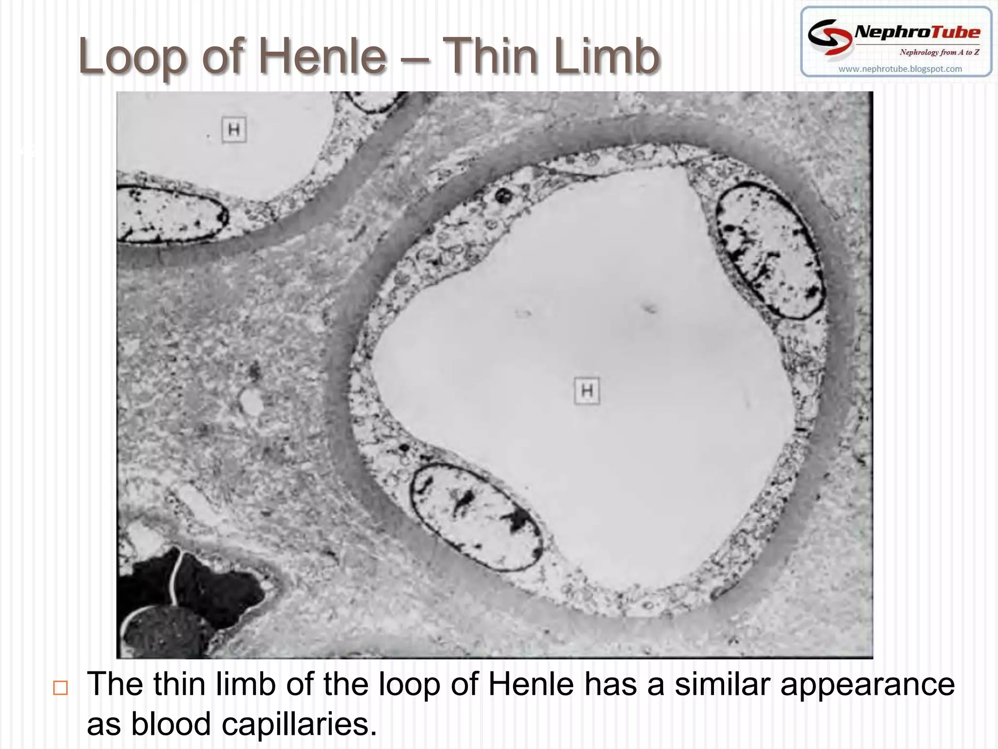 Renal Histo-Pathology (II) - Normal Kidney Electron Microscopy - Dr ...