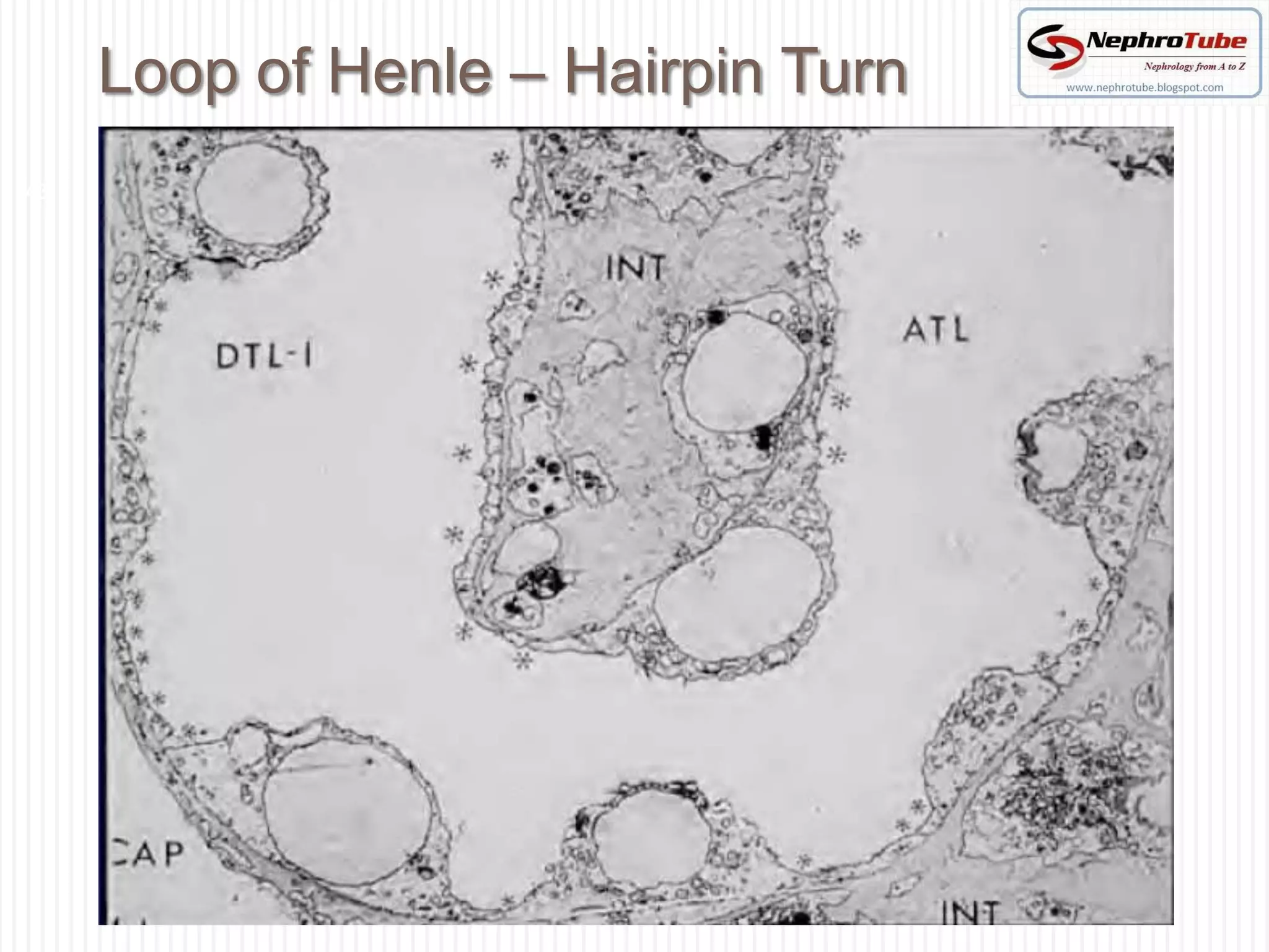Renal Histo-Pathology (II) - Normal Kidney Electron Microscopy - Dr ...