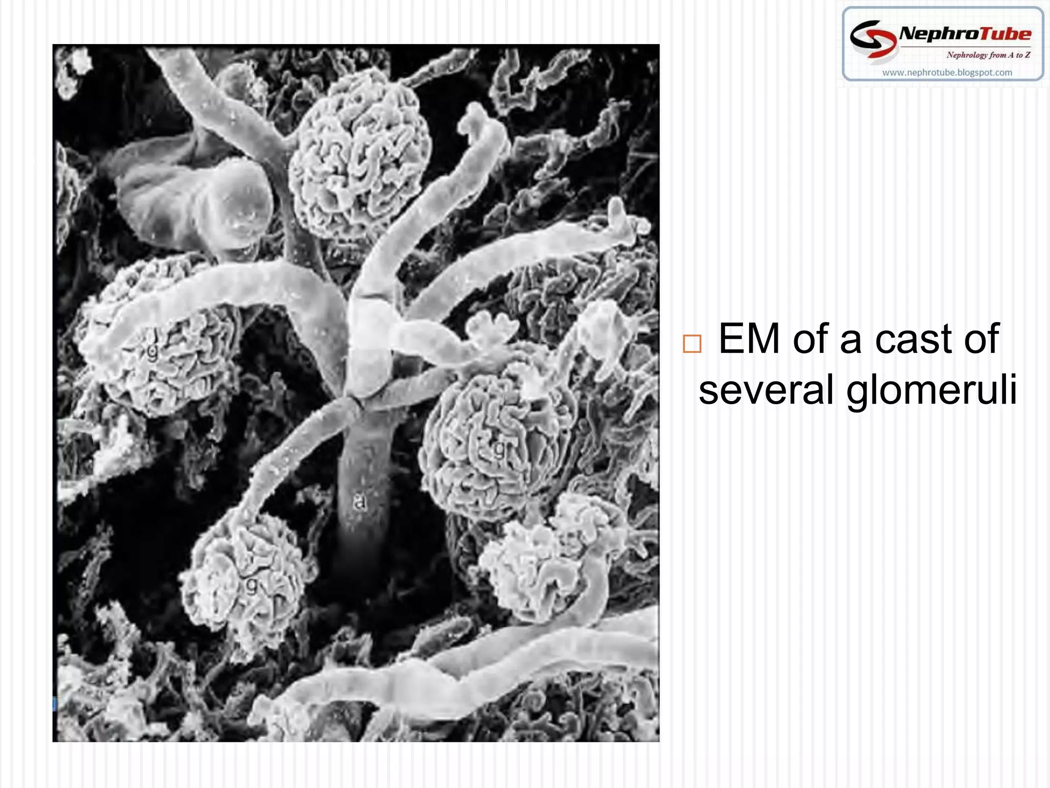 Renal Histo-Pathology (II) - Normal Kidney Electron Microscopy - Dr ...