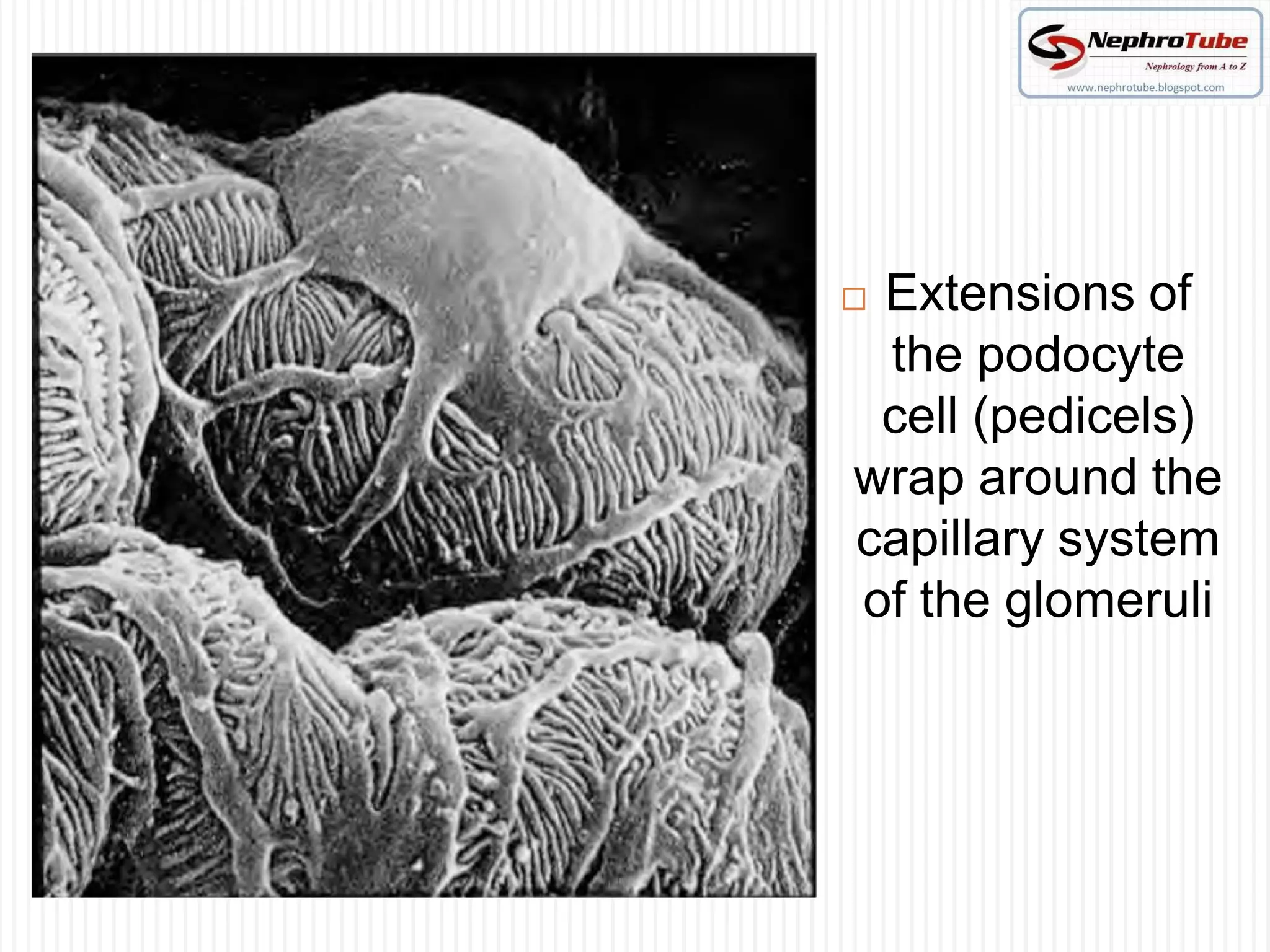 Renal Histo-Pathology (II) - Normal Kidney Electron Microscopy - Dr ...