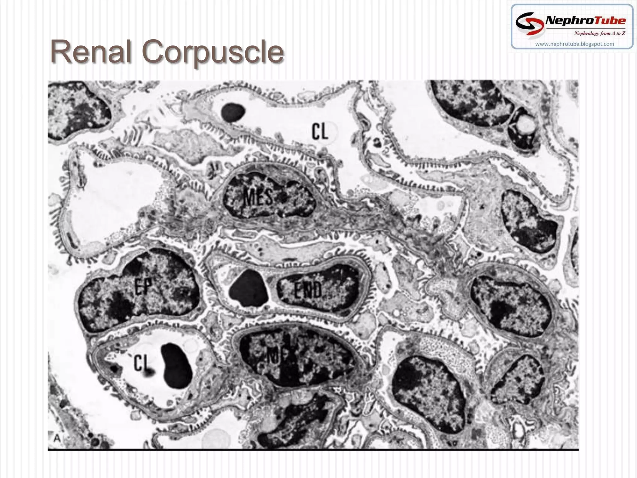Renal Histo-Pathology (II) - Normal Kidney Electron Microscopy - Dr ...