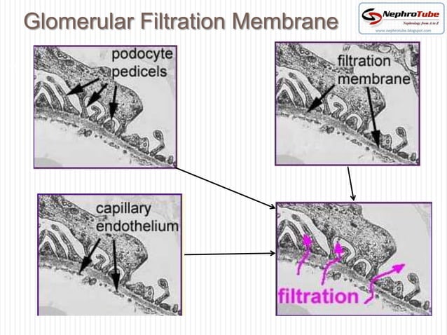 Renal Histo-Pathology (II) - Normal Kidney Electron Microscopy - Dr ...