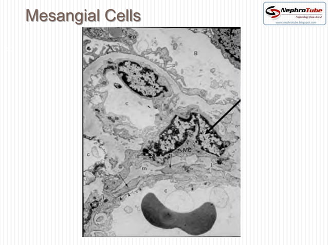 Renal Histo-Pathology (II) - Normal Kidney Electron Microscopy - Dr ...