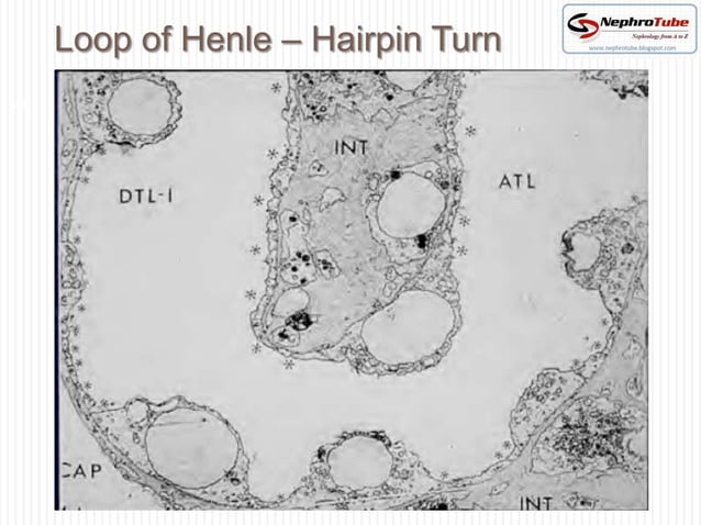 Renal Histo-Pathology (II) - Normal Kidney Electron Microscopy - Dr ...