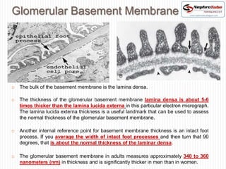 Glomerular Basement Membrane Histology