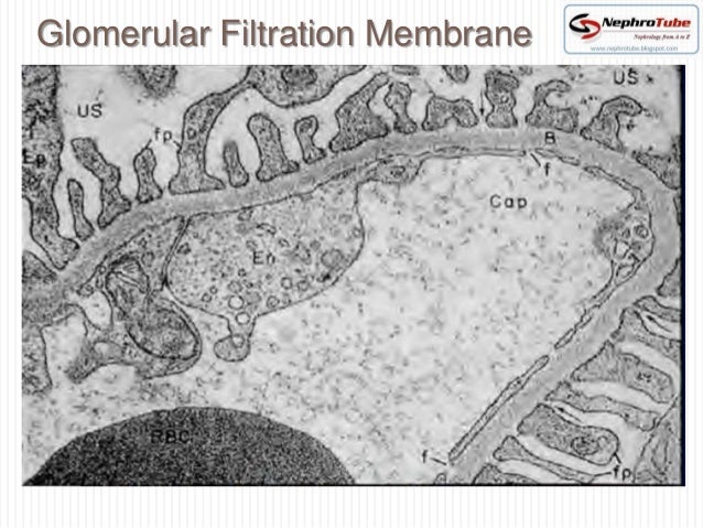 Renal Histo-Pathology (II) - Normal Kidney Electron Microscopy