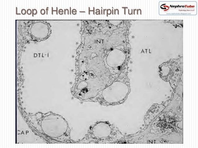 Renal Histo-Pathology (II) - Normal Kidney Electron Microscopy