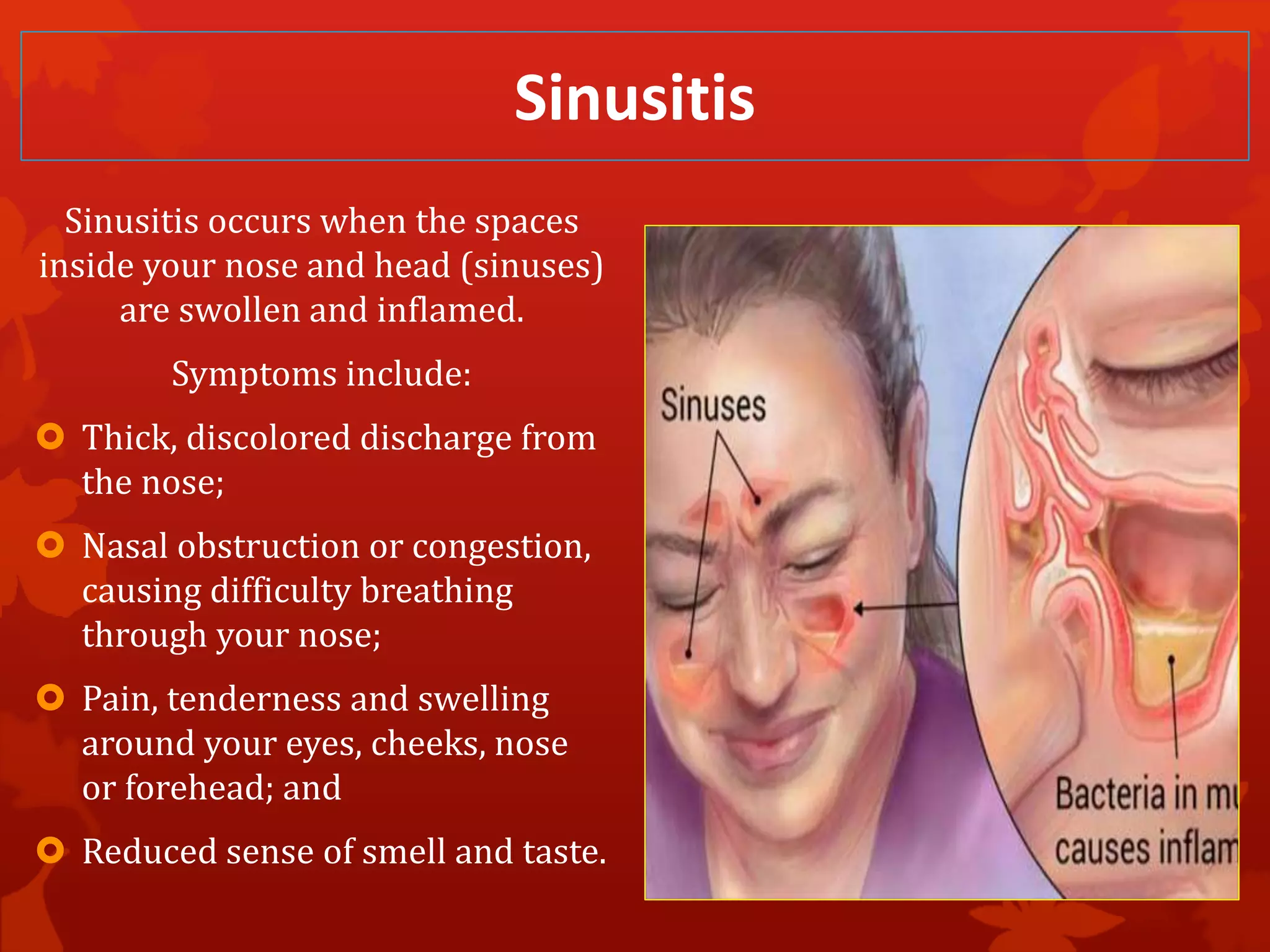 Nose and Sinus Disorders | PPTX