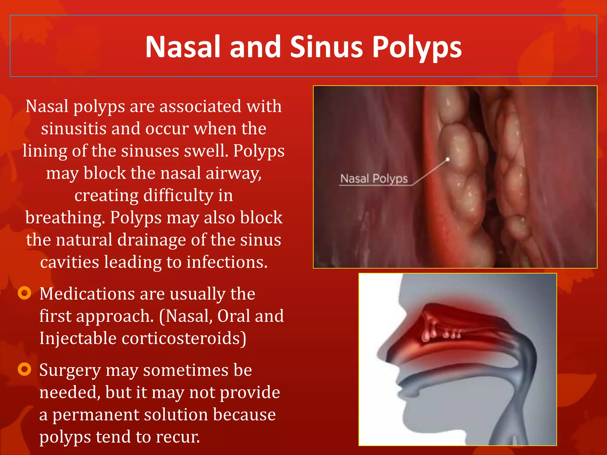 Nose and Sinus Disorders | PPTX